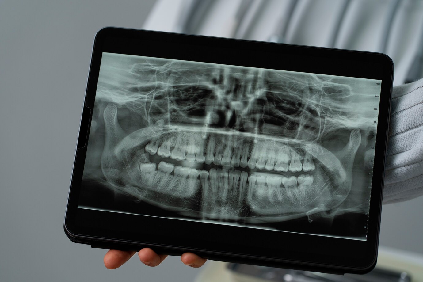 20 year old teeth - Dental Expert Clinic