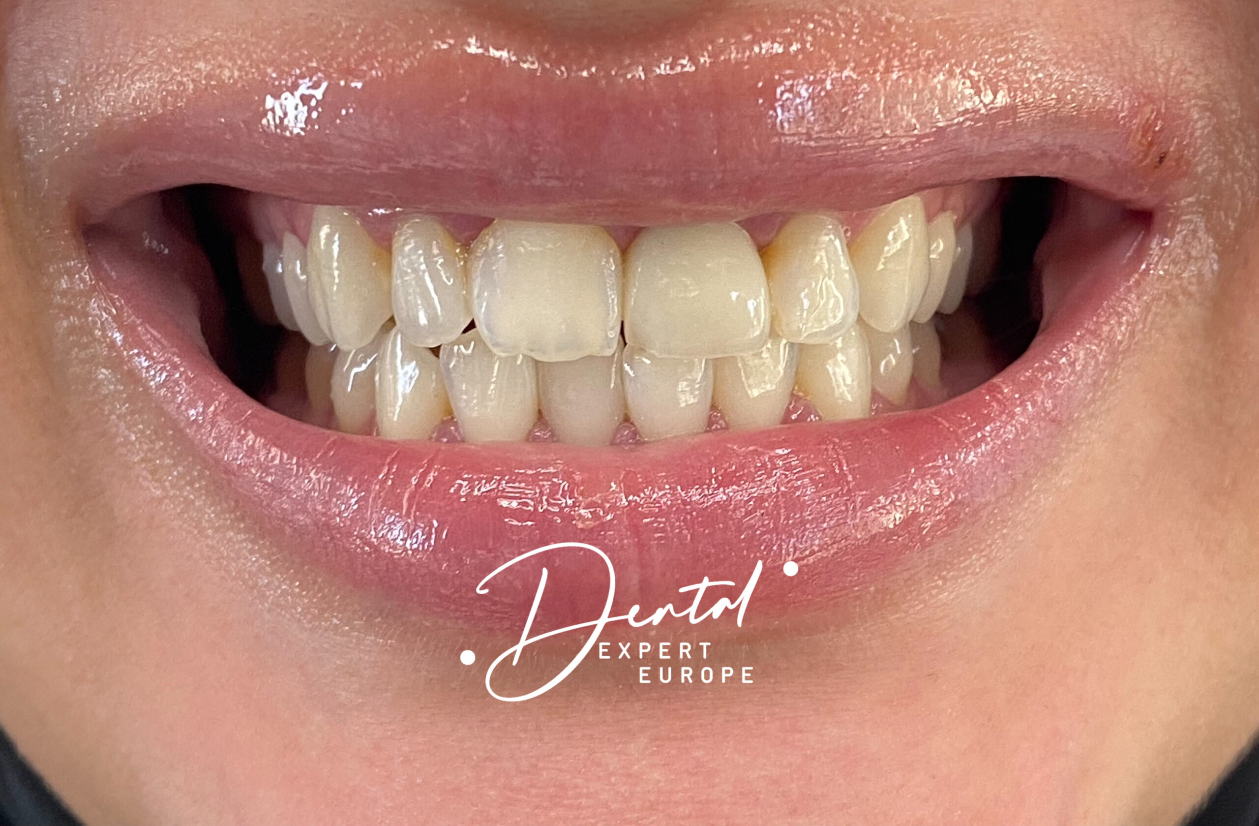 FAQ – Dental Expert Clinic