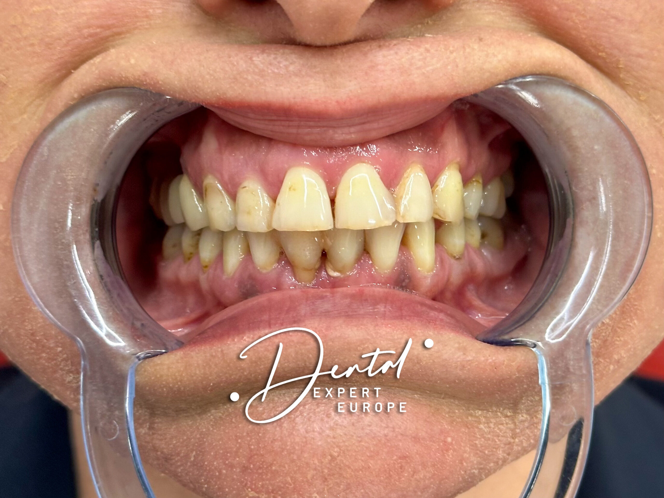 Smile Club – Dental Expert Clinic